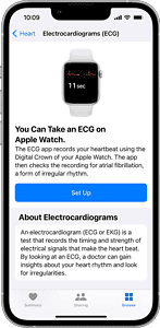 Apple Watch ECG Setup and Use Guide - SimplyMac