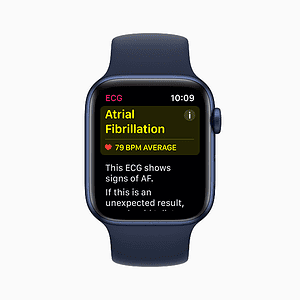 Apple Watch ECG Setup and Use Guide - SimplyMac