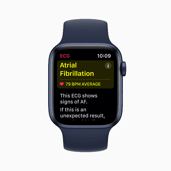 Apple Watch ECG Setup and Use Guide - SimplyMac